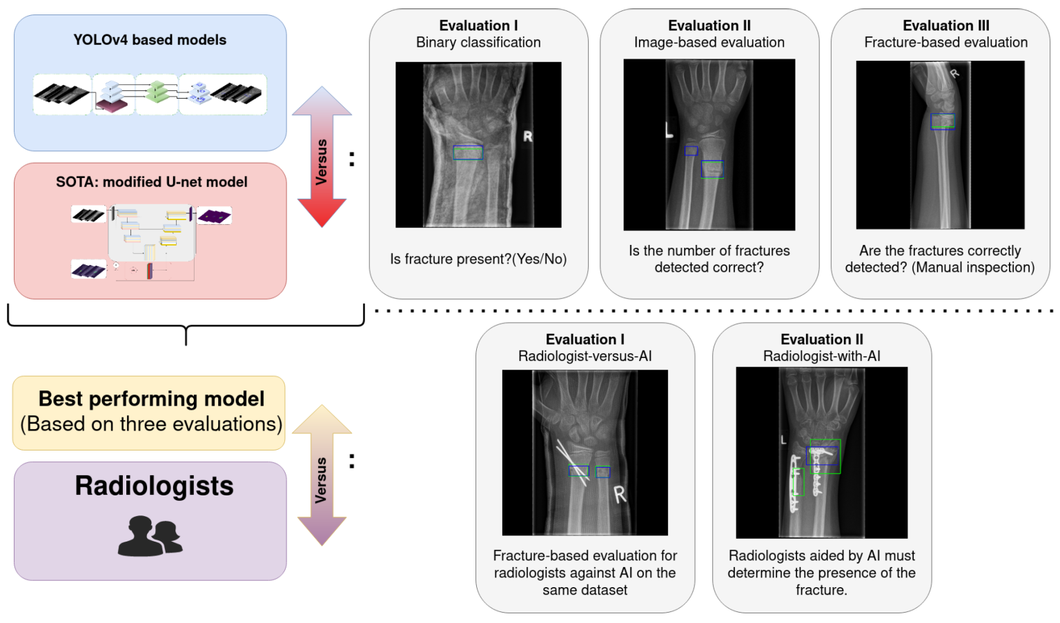 Fracture Recognition in Paediatric Wrist Radiographs: An Object Detection Approach | Center for ...