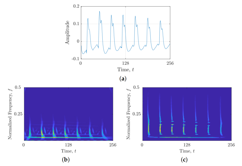 Method for Automatic Estimation of Instantaneous Frequency and Group Delay in Time–Frequency ...